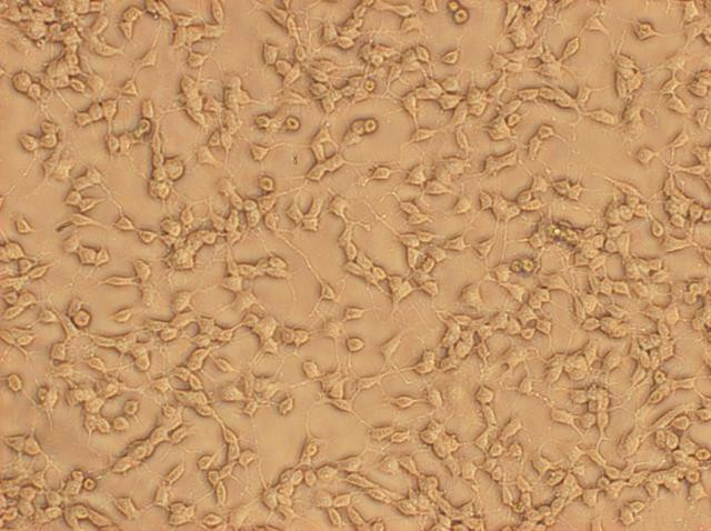 4T1-LUC荧光标记细胞株价格_品牌:ATCC、sciencell、ICLC-丁香通官网